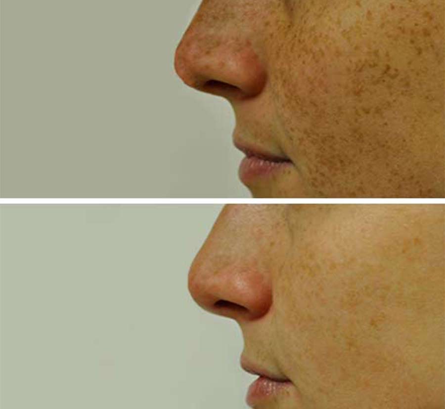 Before and After Photos of Clients in Northridge, CA