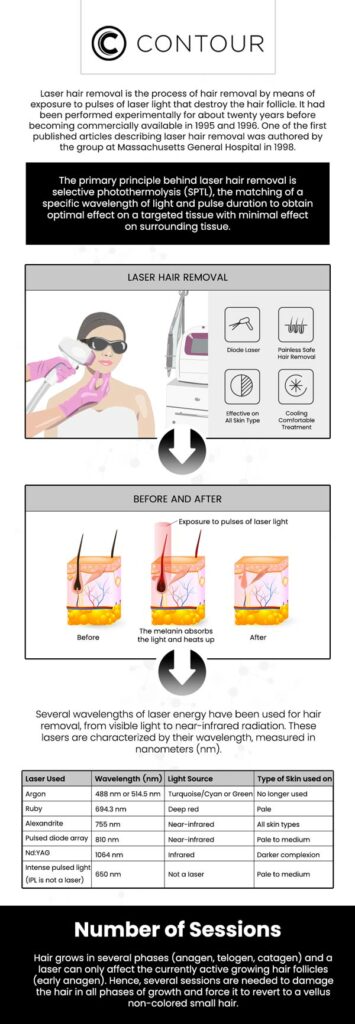 Laser Hair Removal Near Me in Northridge, Los Angeles, CA