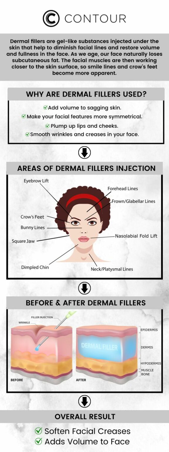 Dermal Filler Specialist Near Me in Northridge, Los Angeles CA